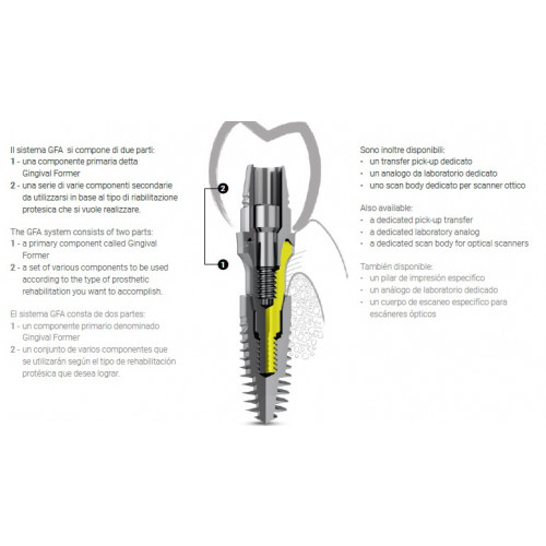 Implantiem Shop - GINGIVAL FORMER h. 2,0mm.